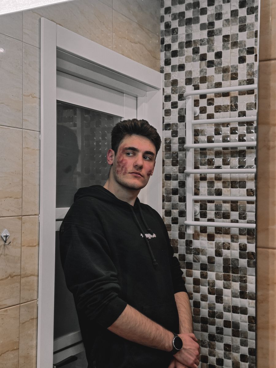 Mike Hidden ️ Live Cams | Skype, Teams, Discord & Telegram